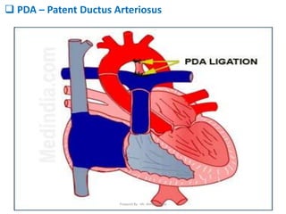 Congenital Heart Disease.pptx