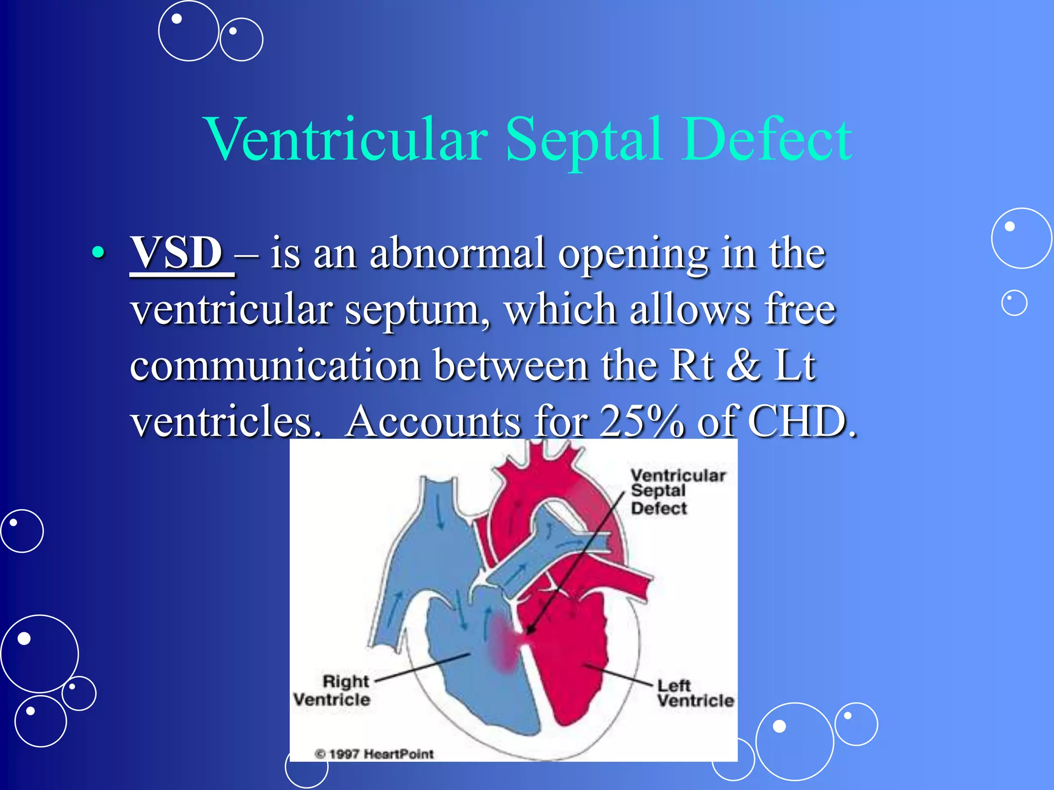 Congenital heart disease | PPT