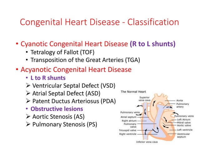 Congenital heart disease 2021 | PDF | Heart and Cardiovascular Diseases ...