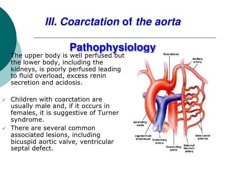 surgery.Congenital heart disease.(dr.aram)