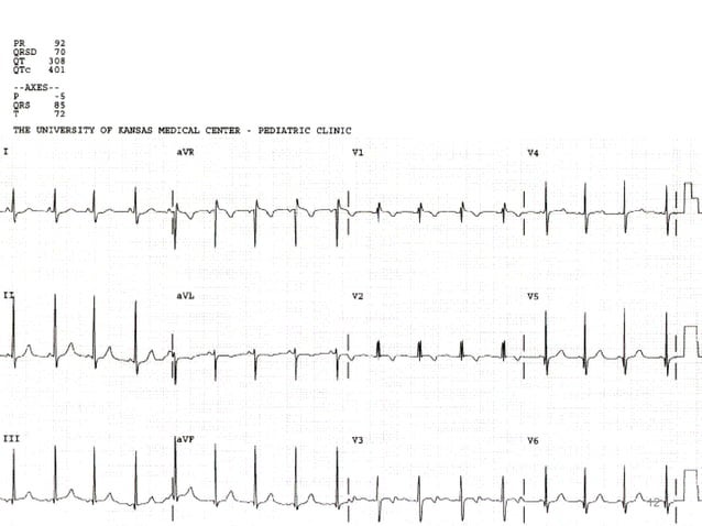 Congenital heart disease (chd) | PPT