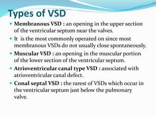 Congenital Heart Disease CHD - Pediatrics Ward | PPTX