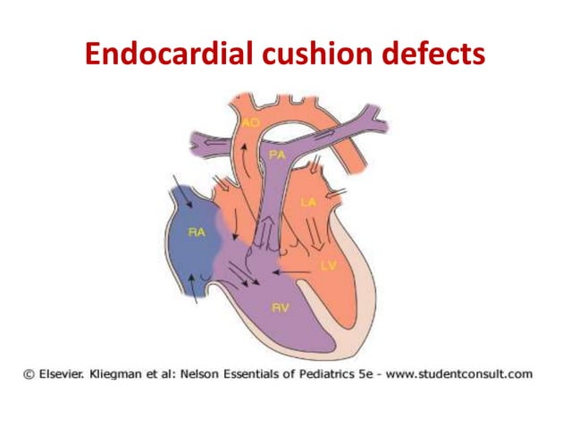 cyanotic and acyanotic Congenital heart disease for undergraduated ...