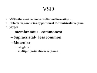 Congenital heart disease | PPTX
