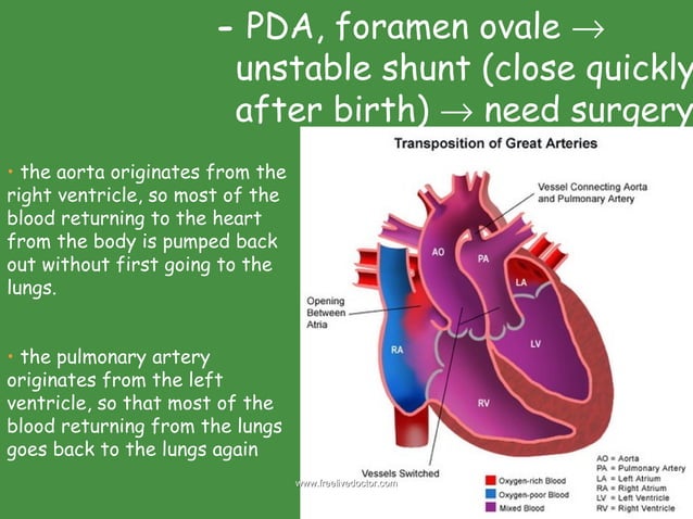 Congenital heart disease heart failure | PPT | Heart and Cardiovascular ...