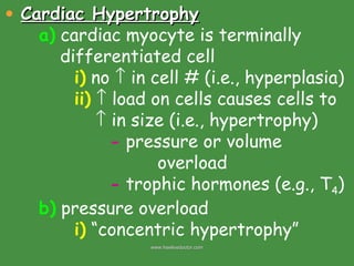 Congenital heart disease heart failure | PPT