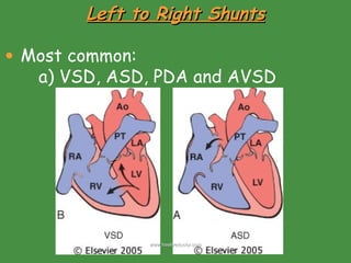 Congenital heart disease heart failure | PPT | Heart and Cardiovascular ...