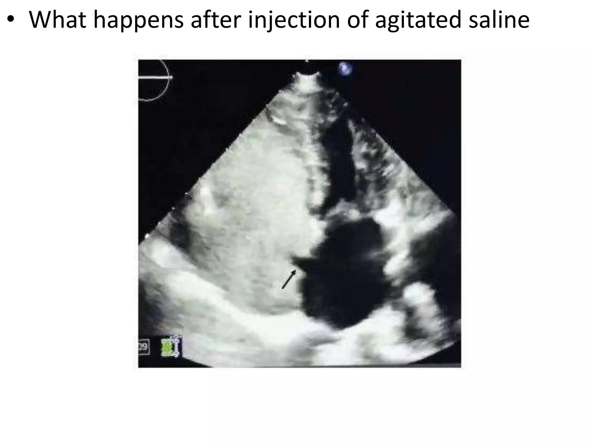 Congenital heart disease part 2.pptx