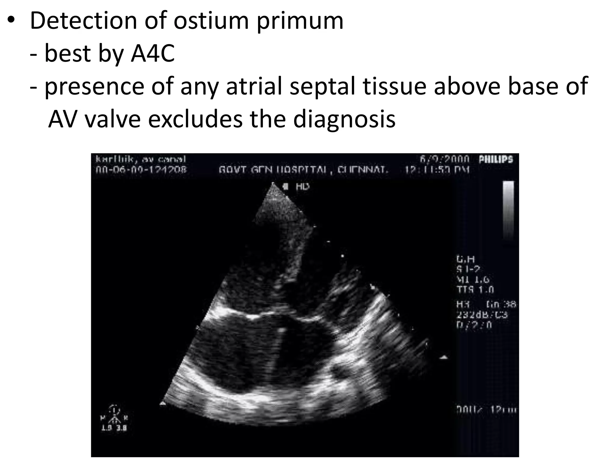 Congenital heart disease part 2.pptx