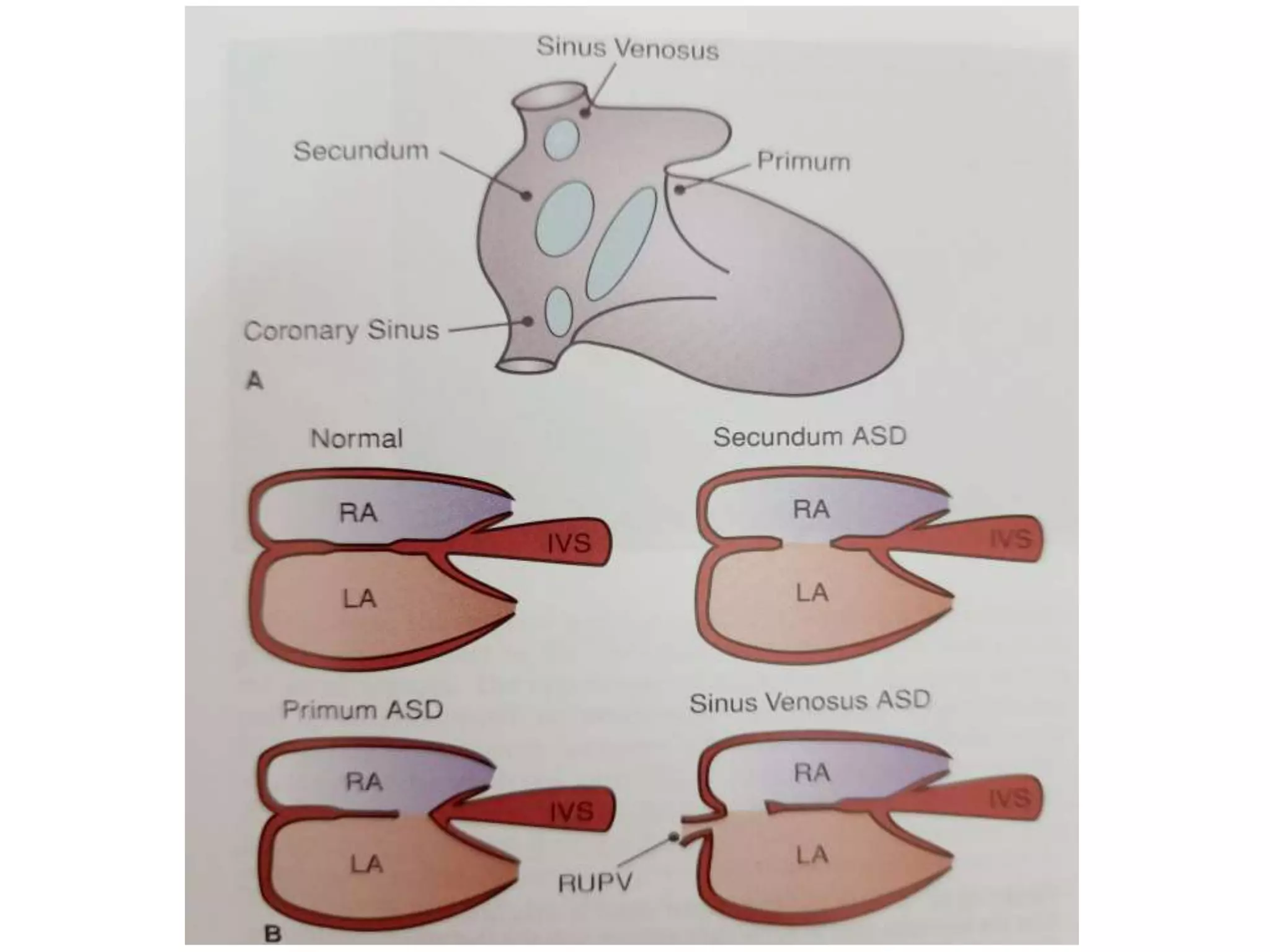 Congenital heart disease part 2.pptx