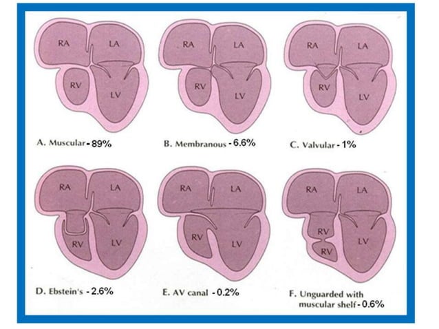 Congenital heart disease part 3.pptx
