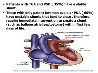 Congenital heart diseases 1 | PPT
