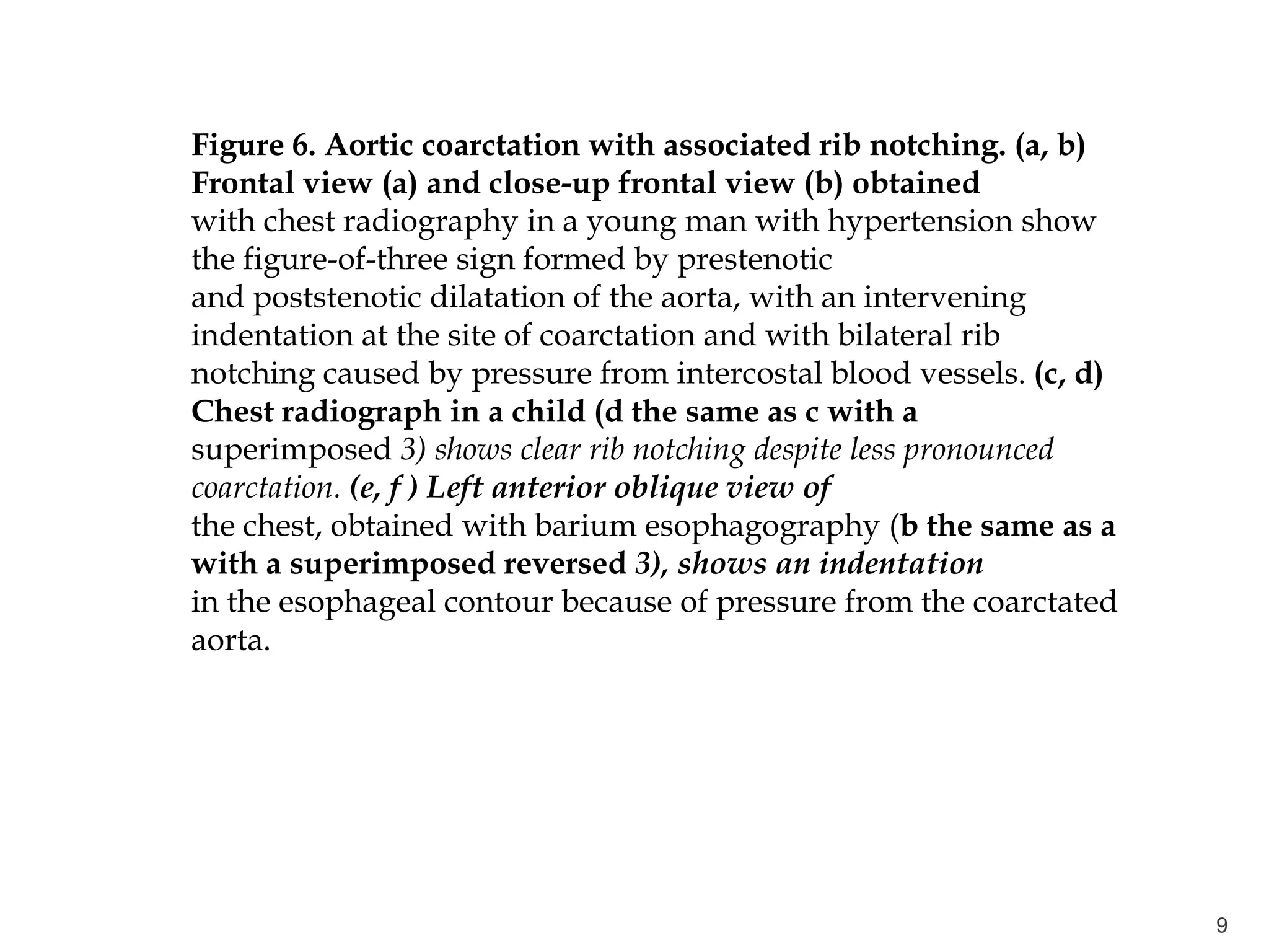 Congenital Heart Diseases | PPTX