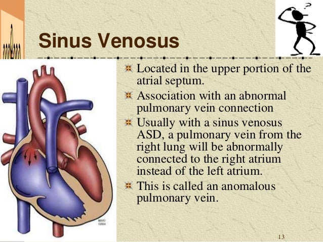 Congenital heart disease