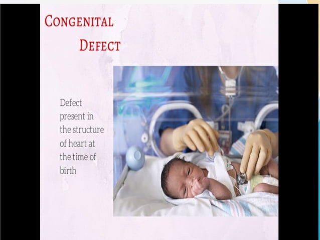 Congenital heart diseases | PPT