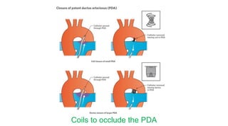 Congenital heart diseases | PPTX