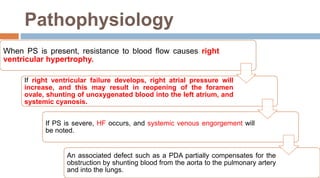 Congenital heart diseases | PPTX