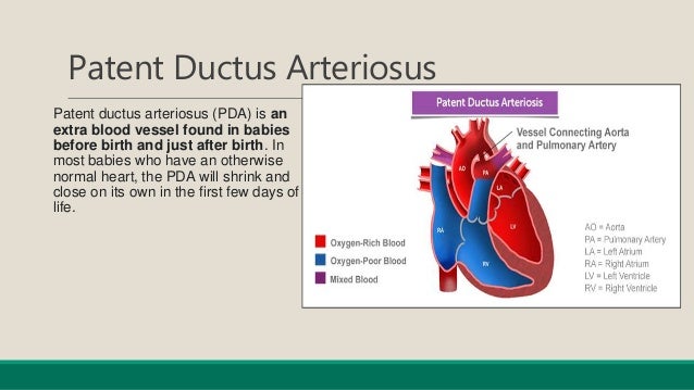Congenital heart diseases | PPTX