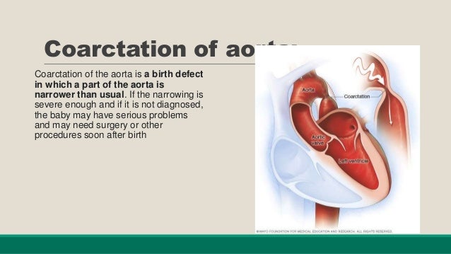 Congenital heart diseases | PPTX