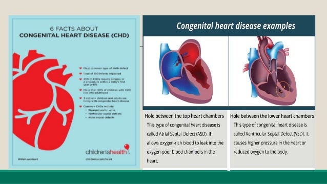 Congenital heart diseases | PPTX
