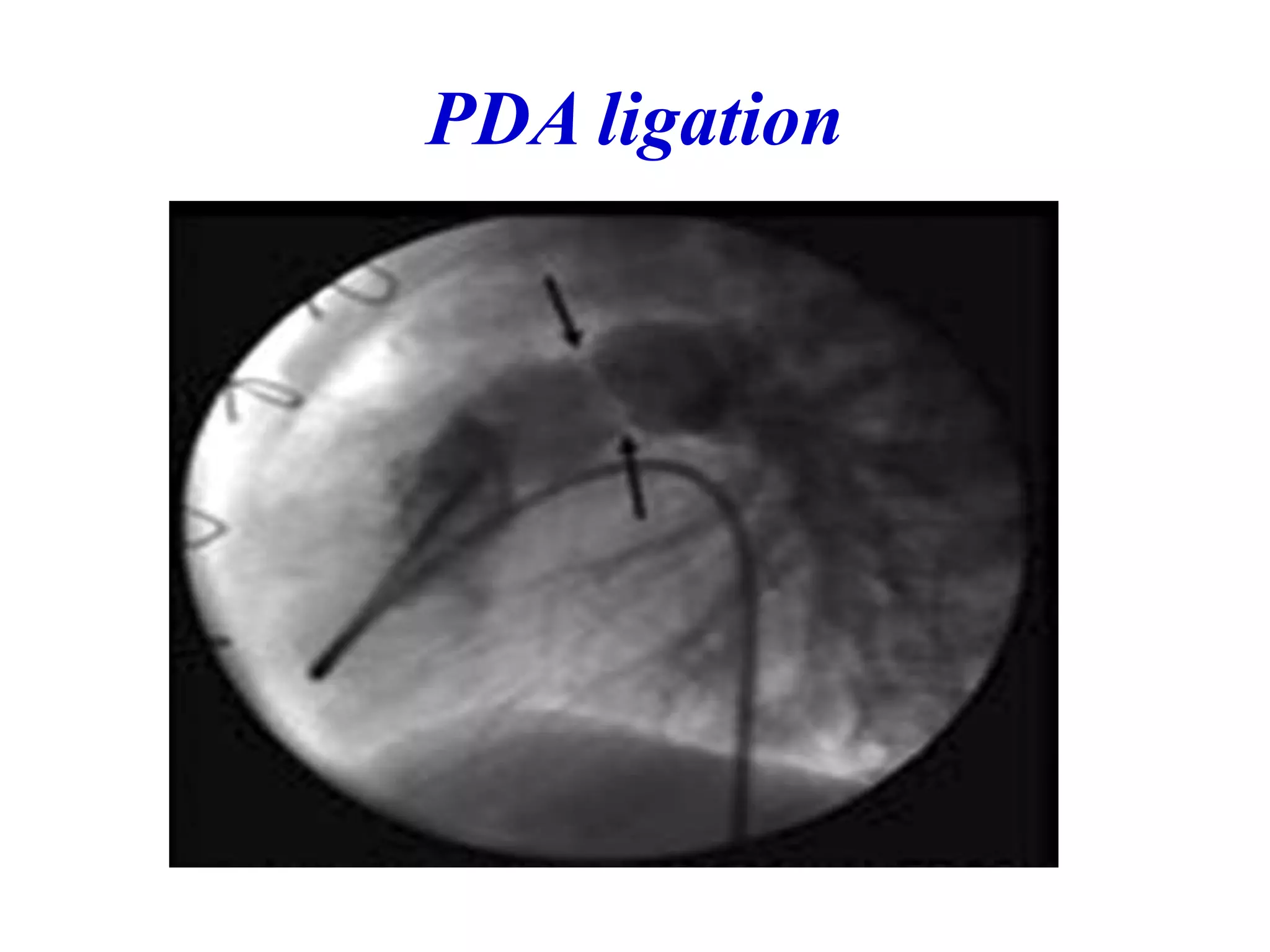 CONGENITAL HEART DISEASES.pptx