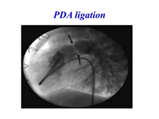 CONGENITAL HEART DISEASES.pptx