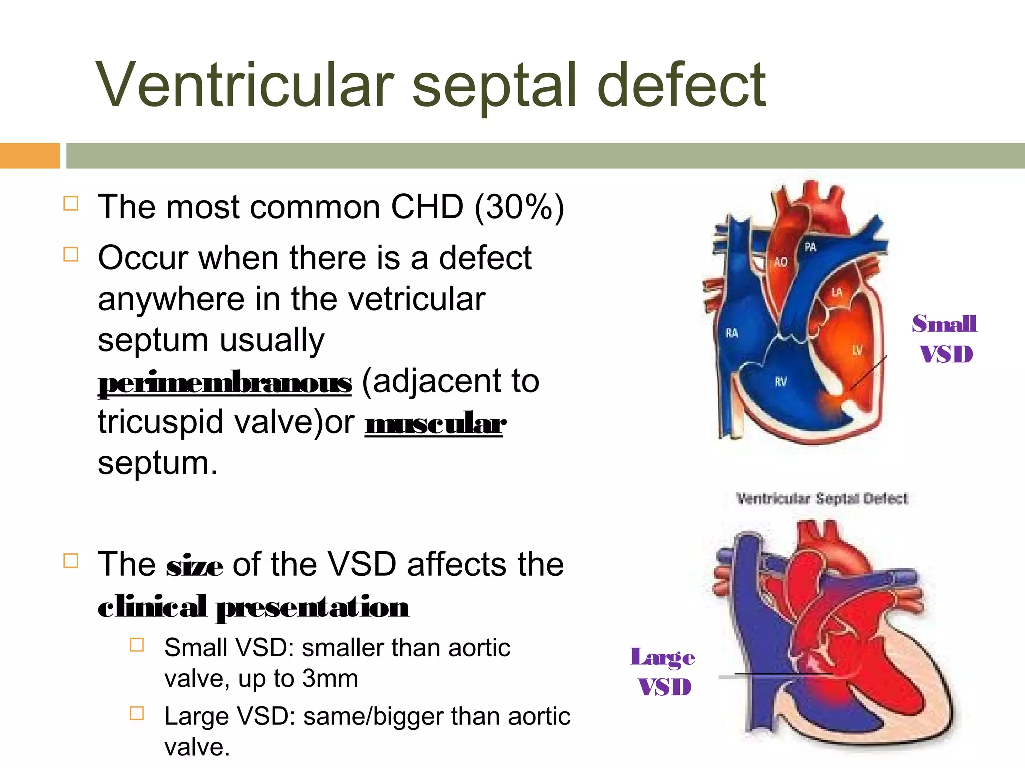 Congenital heart diseases | PPT