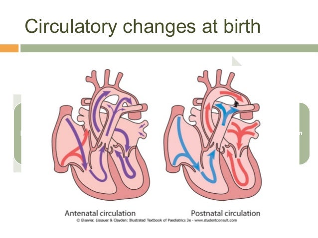 Congenital heart diseases