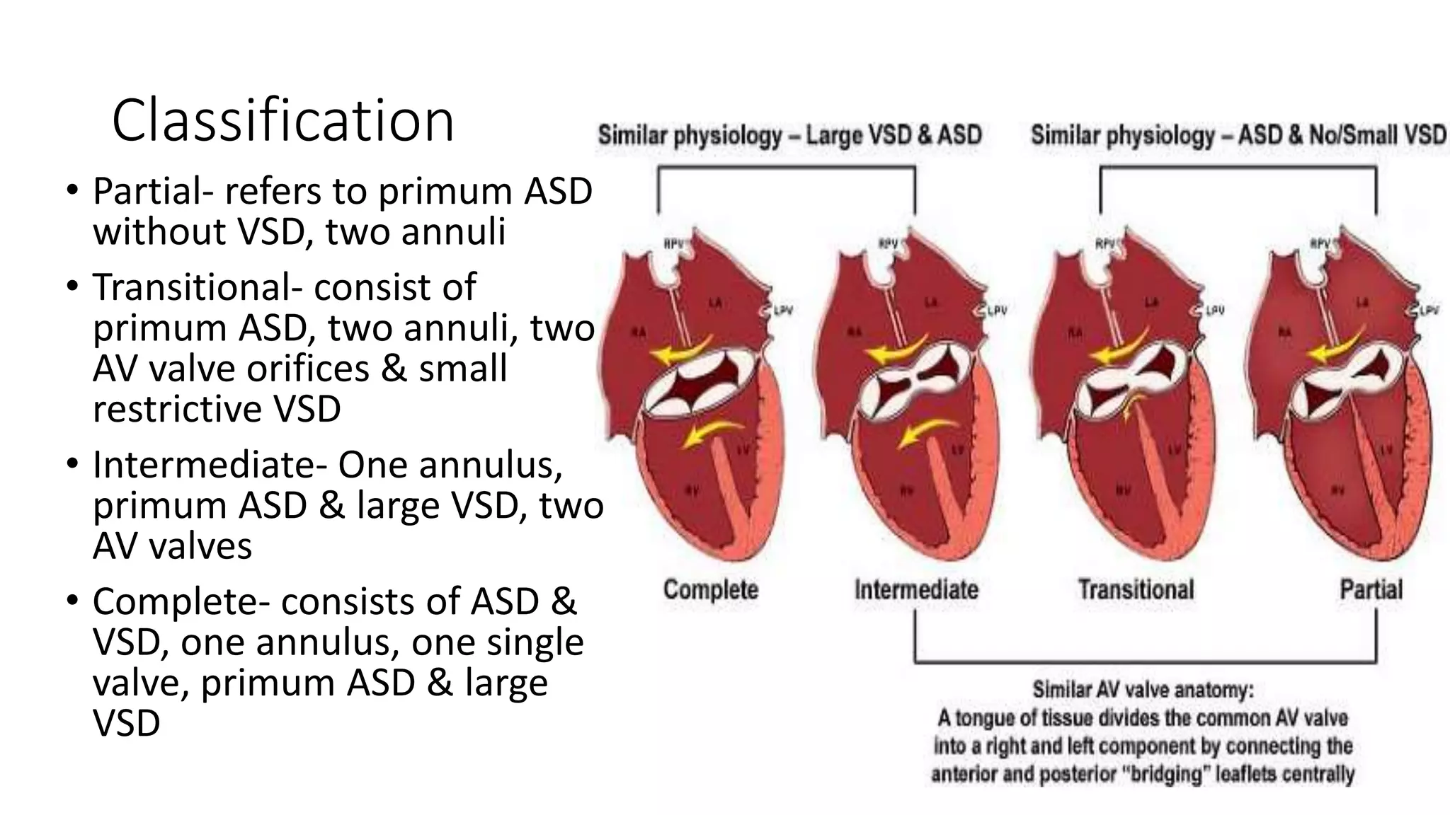 Congenital heart diseases (acyanotic) | PPTX