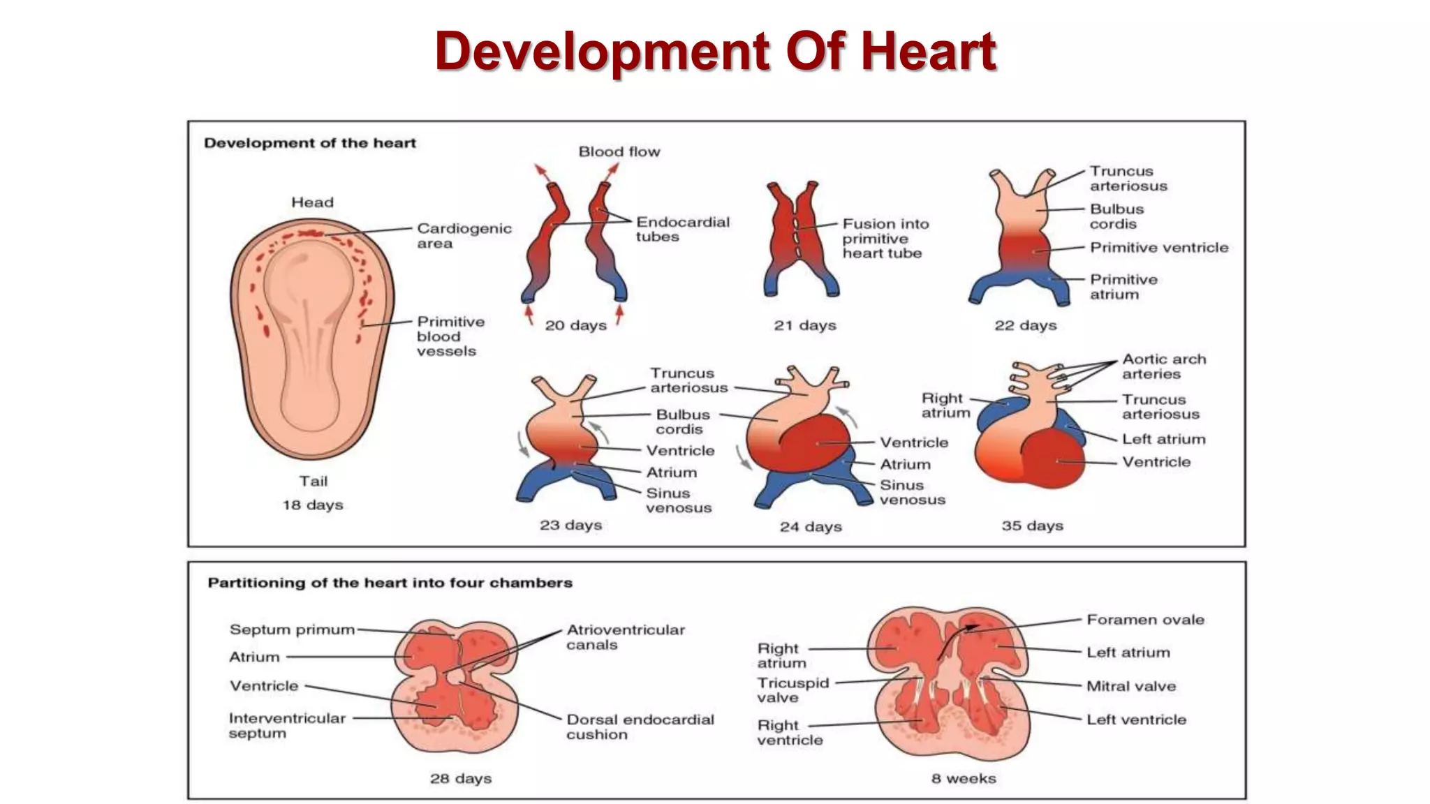 Congenital Heart Diseases in Children.pptx