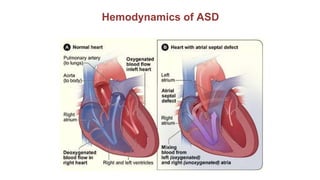 Congenital Heart Diseases in Children.pptx