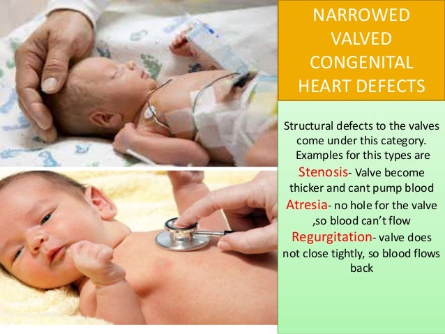 Congenital Heart Disease Treatment India congenital-heart-disease-treatment-india