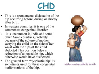 congenitalhipdislocation-181019181229.pptx