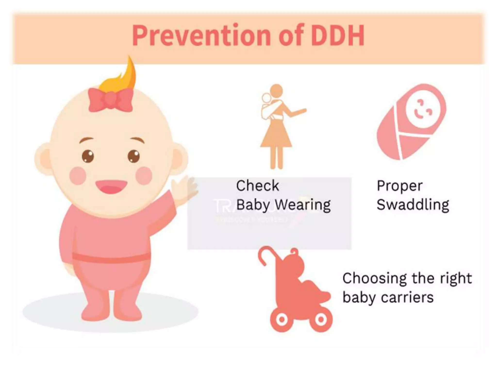 Congenital hip dislocation | PPTX