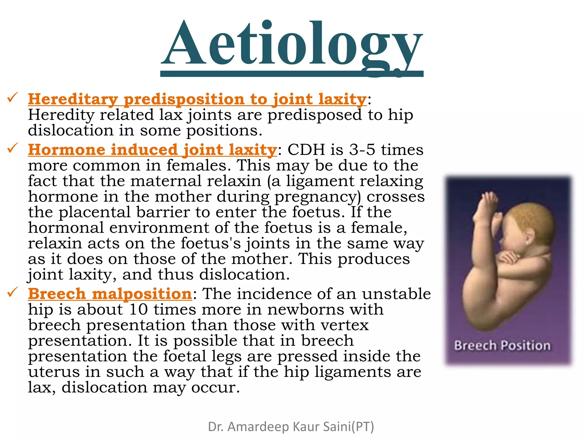 Congenital hip dislocation | PPTX