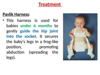 congenital hip dislocation .pptx