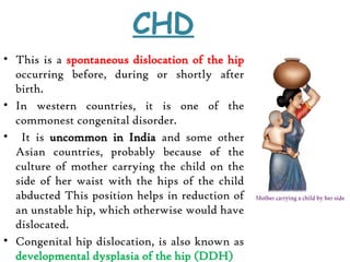 congenital hip dislocation .pptx