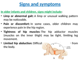 congenital hip dislocation .pptx