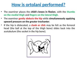 congenital hip dislocation .pptx