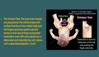 ppt aboout congenital hip dysplasia.pptx