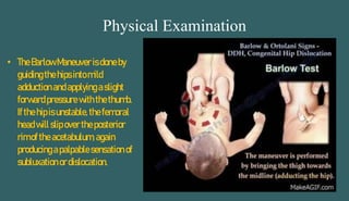 ppt aboout congenital hip dysplasia.pptx