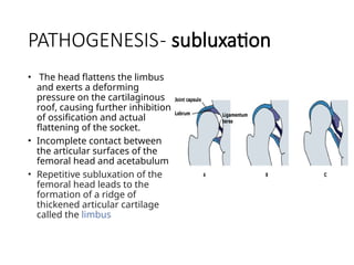 Congenital Hip Dysplasia involving subluxation | PPTX