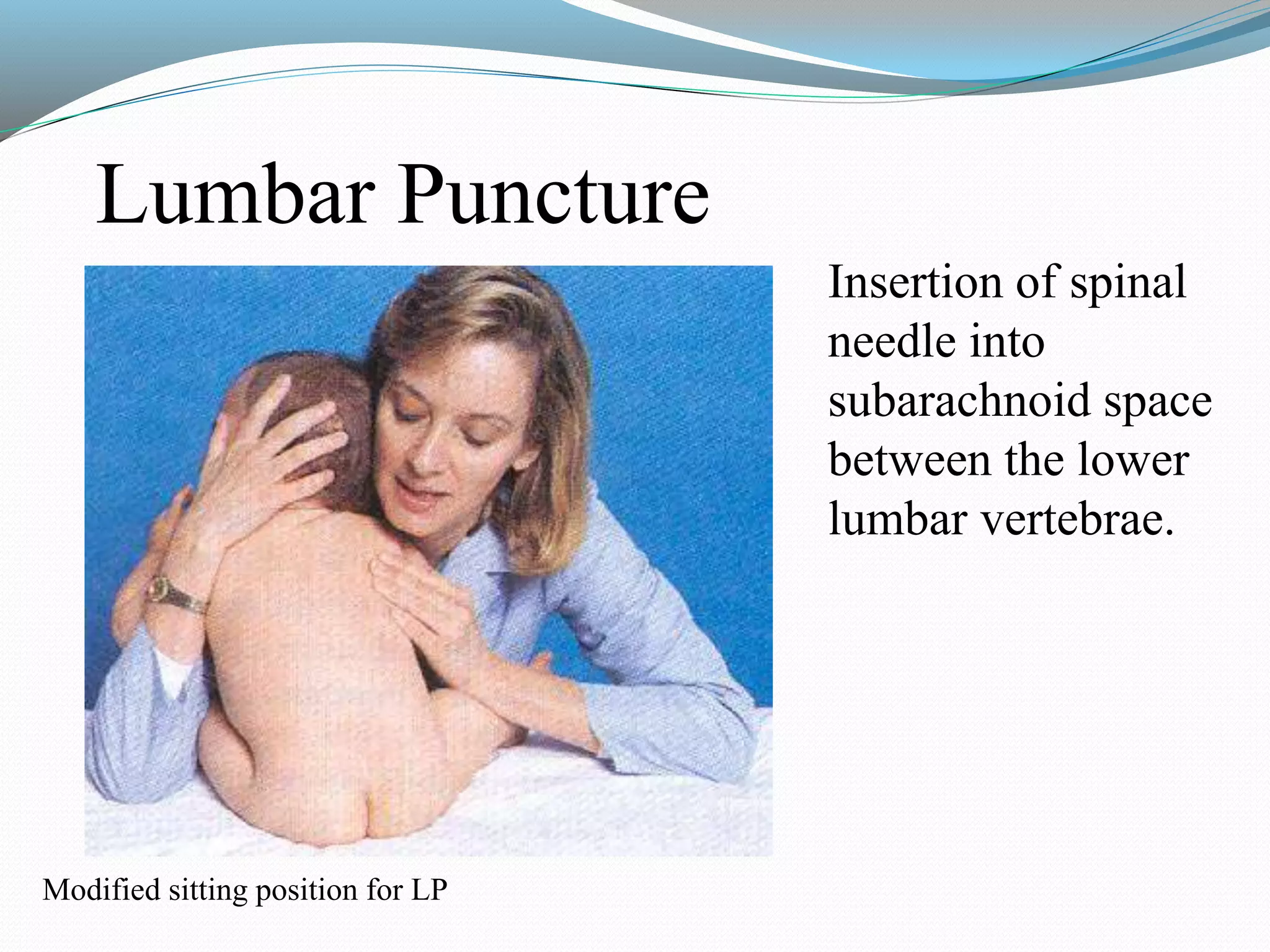 Hydrocephalus | PPTX