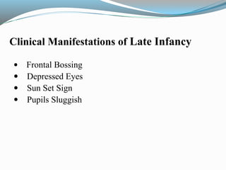 Hydrocephalus | PPTX