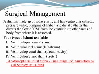 Hydrocephalus | PPTX