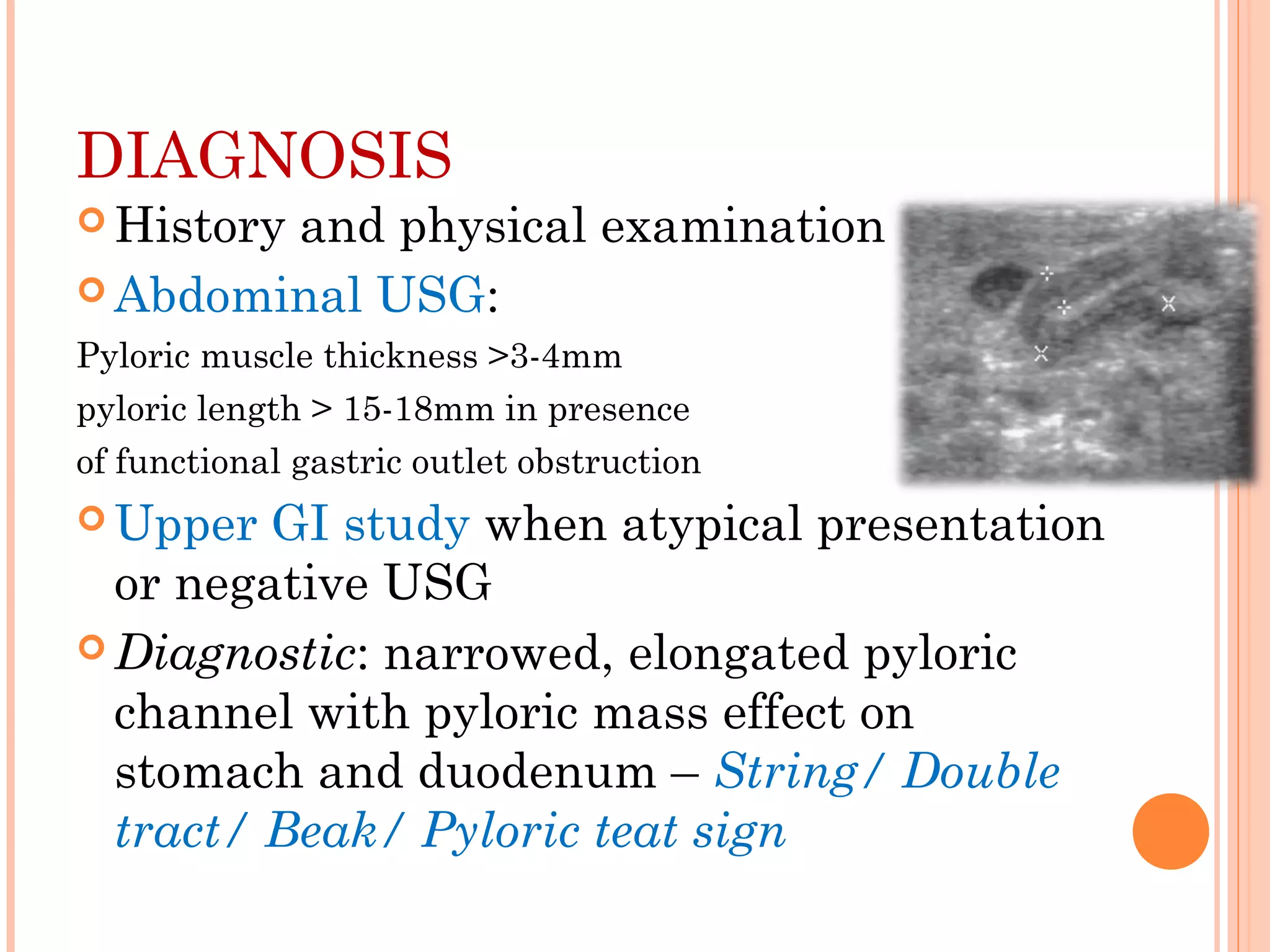 Congenital hypertrophic pyloric stenosis | PPT