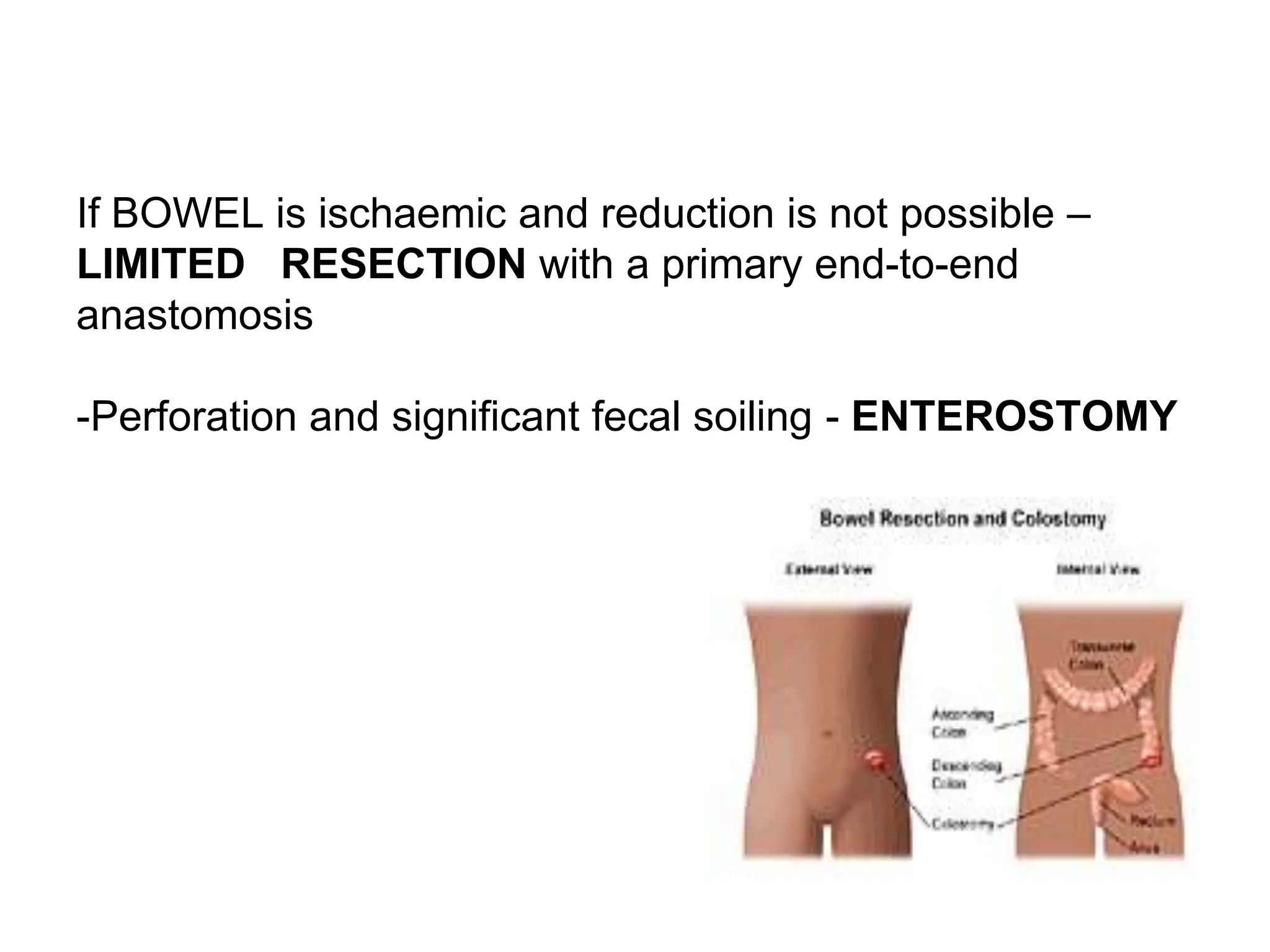 congenitalhypertrophicpyloricstenosis.pptx