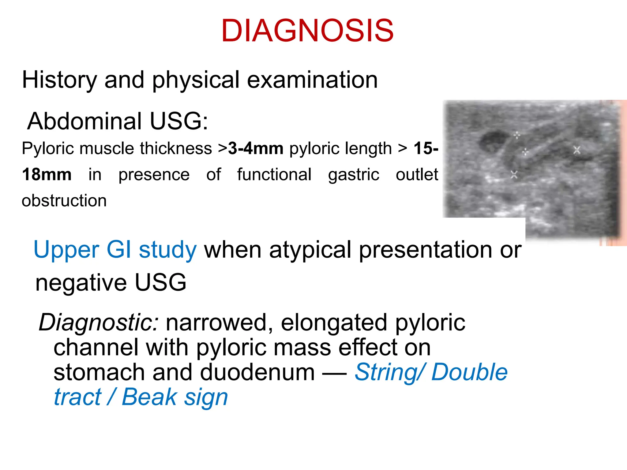 congenitalhypertrophicpyloricstenosis.pptx