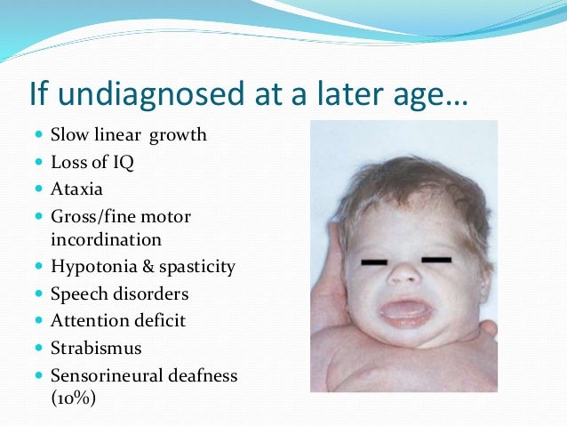 Congenital hypothyroidism