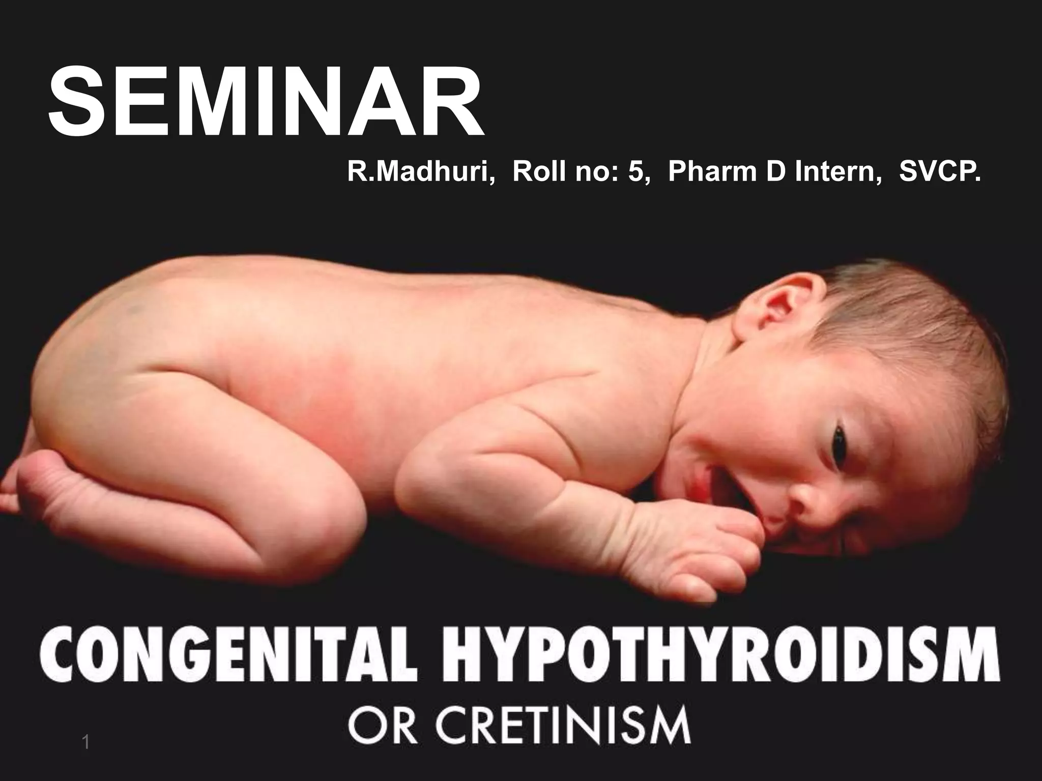 Congenital hypothyroidism | PPTX